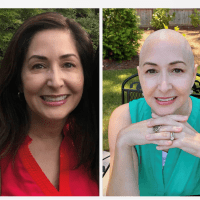Chemotherapy and Side Effects – Ela K. Browder